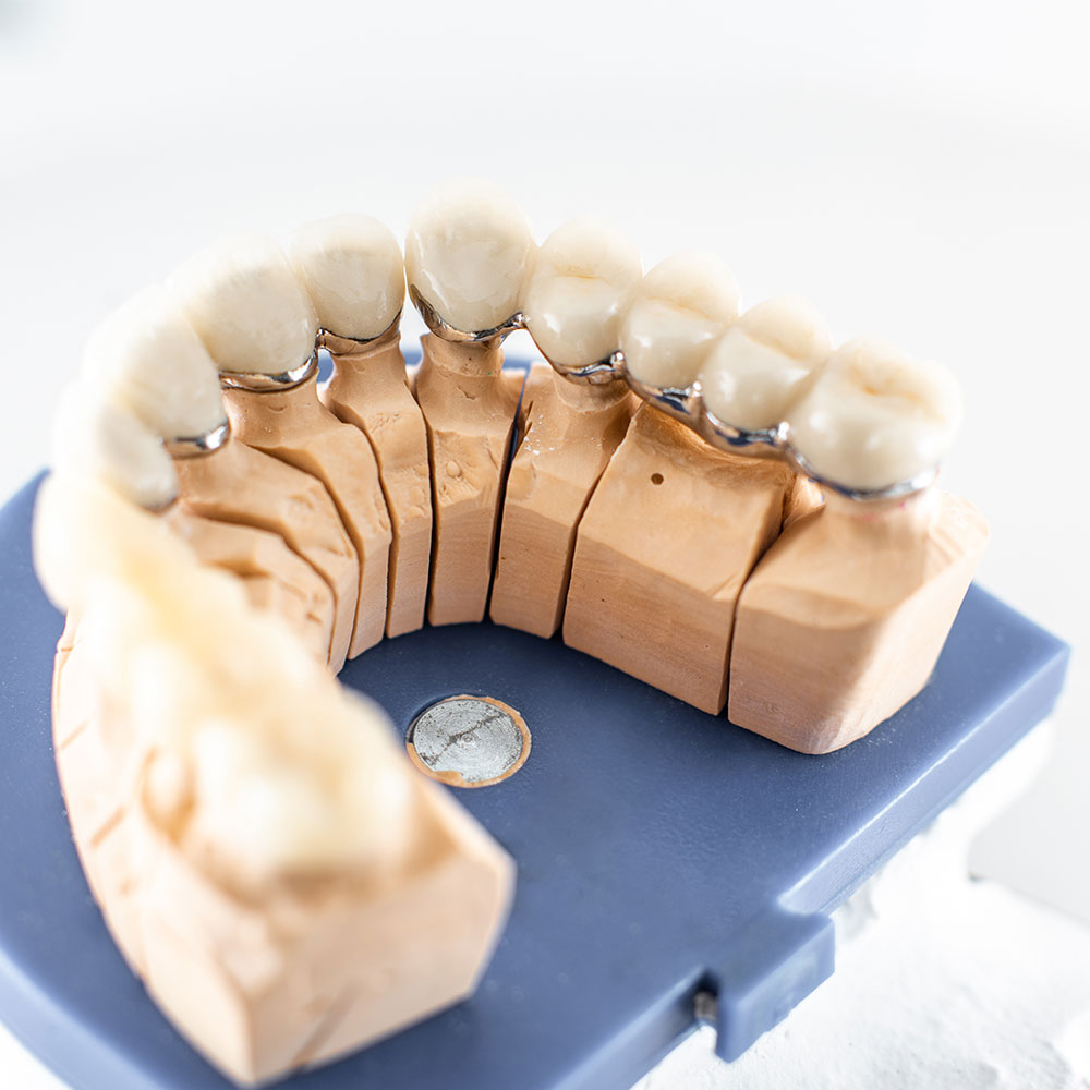 Zirconium Coating - A. Burak Zorlu